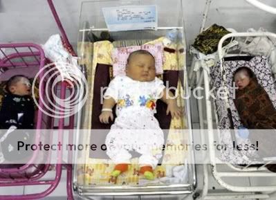 Gigantic 19 POUND (newborn) Baby draws crowds at Indonesian hospital ...